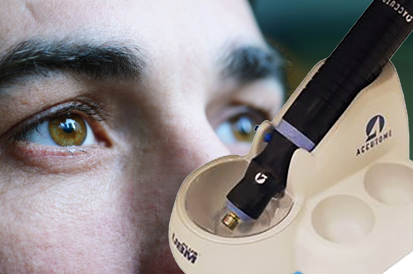 Biomicroscopia Ultrassônica - Médicos de Olhos S.A