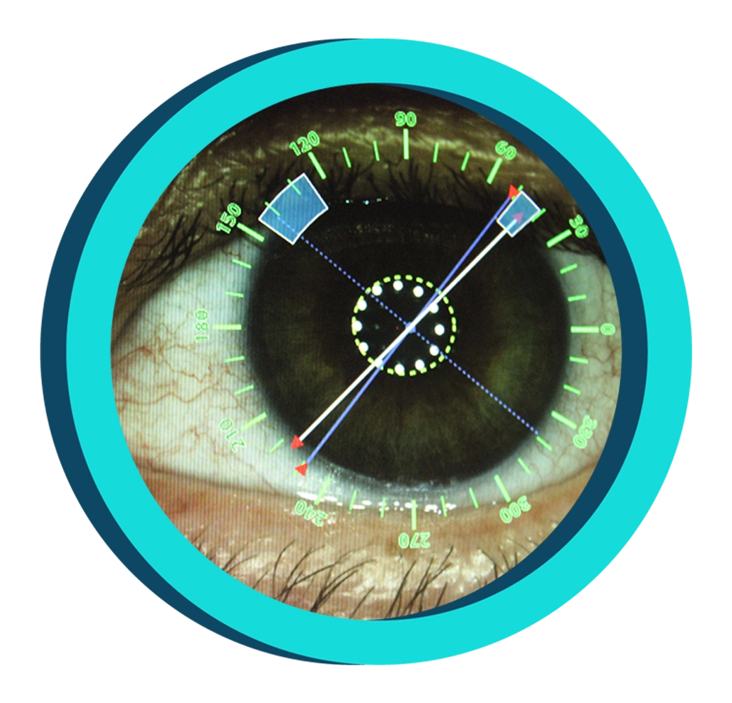 Sistema Verion | Médicos de Olhos